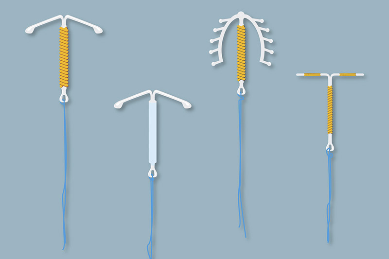 Como funciona o DIU e porque ele evita a gravidez